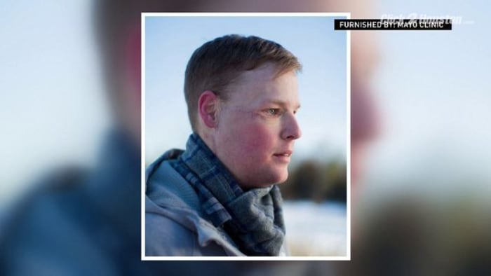 Mayo Clinic's first facial transplant recipient speaks about mental health