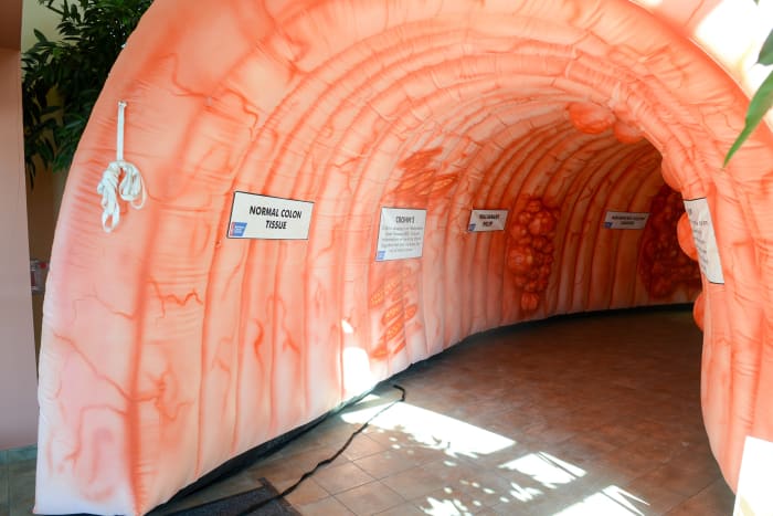 Giant inflatable colon on display today at Henry Ford West Bloomfield ...