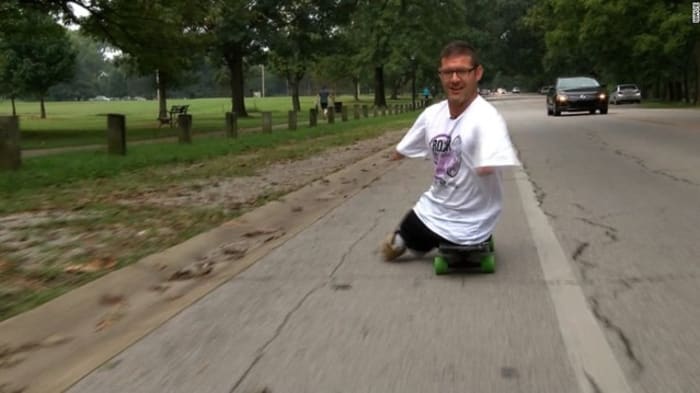 Video: Man born without arms, legs participates in 5K