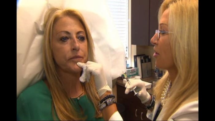 Injections to fight fine lines