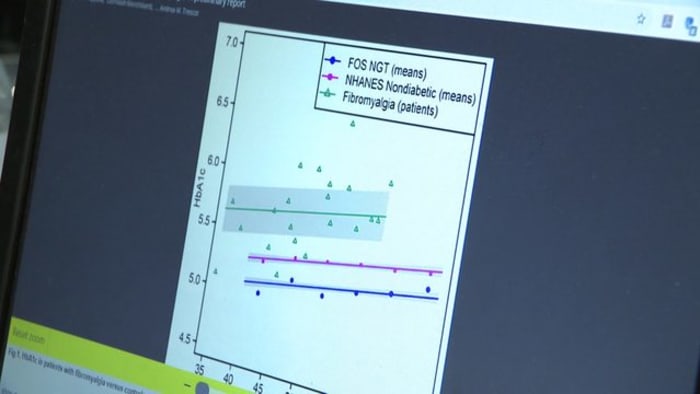 UTMB doctor discovers promising pain relief for fibromyalgia patients