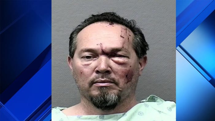 Accused drunken driver arrested after 1 killed, injured 11 in 5-vehicle ...