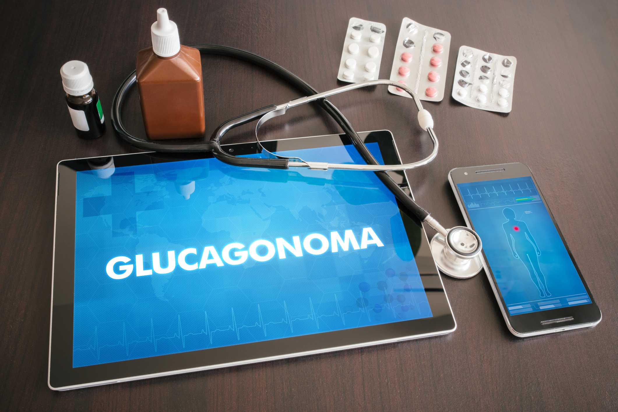 Glucagonoma - Glucagonoma Causes, Risk Factors, Testing & Treatment