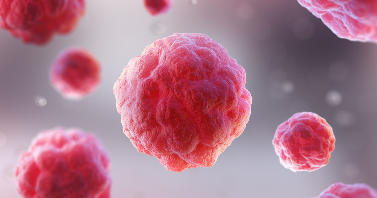 Encapsulation - Encapsulated Islet Cells as a Type 1 Treatment