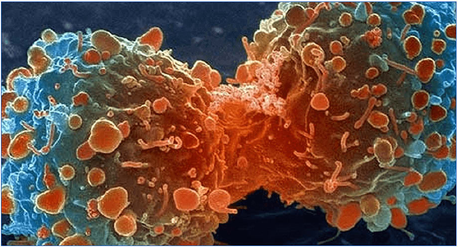 Escozul® | Blog: ¿Que es el cáncer y cómo influye en nuestra vida?