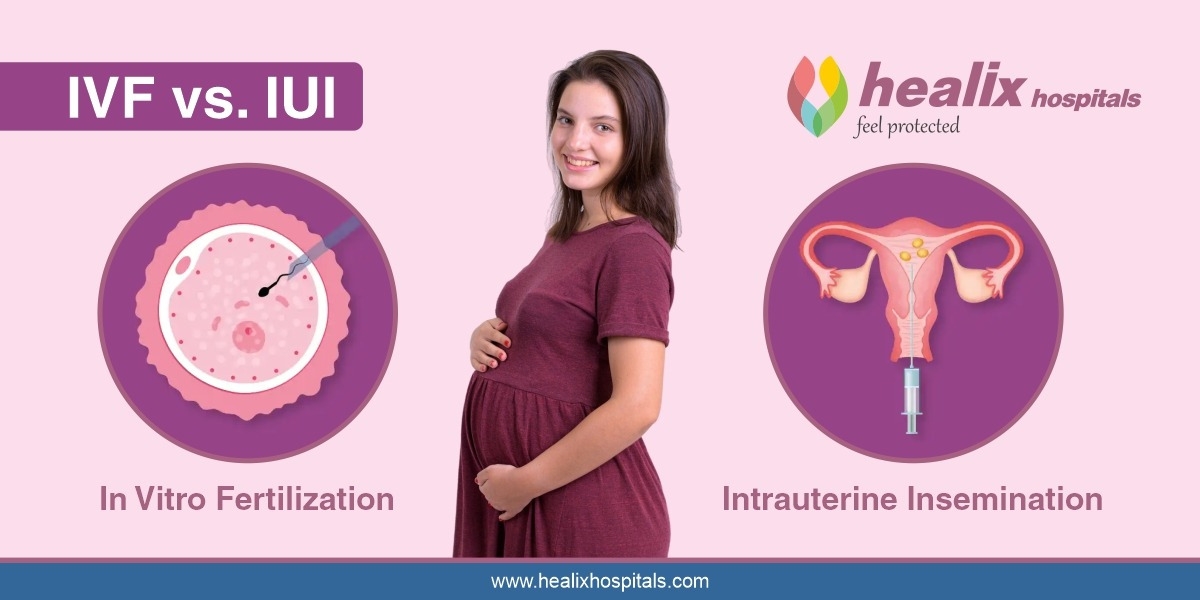 IVF vs. IUI: Choosing the Right Fertility Treatment