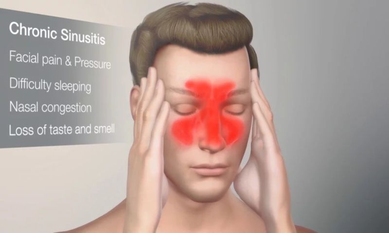 Chronic Sinusitis