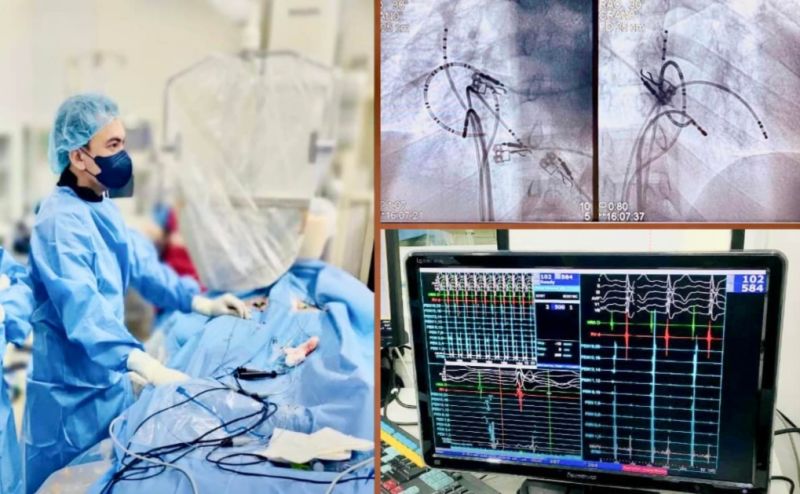 Cardioversion vs. Catheter Ablation