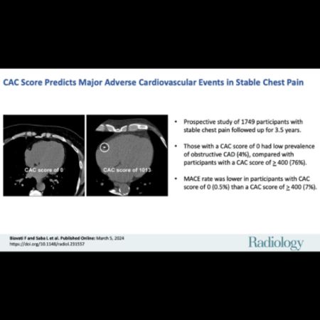 Coronary Artery Calcium Score Could be Predictor of Heart Attacks & Strokes