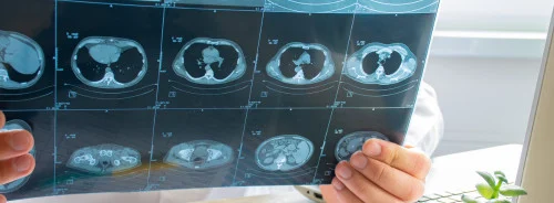 Nuance PowerShare Network: Industry's Largest Imaging Exchange