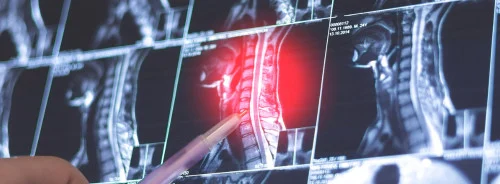 Nuance PowerShare Network: Industry's Largest Imaging Exchange