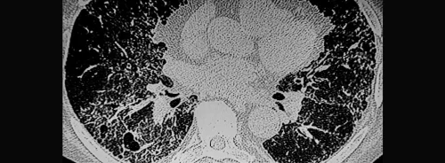 Nuance PowerShare Network: Industry's Largest Imaging Exchange