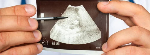 Nuance PowerShare Network: Industry's Largest Imaging Exchange