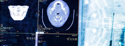 Nuance PowerShare Network: Industry's Largest Imaging Exchange