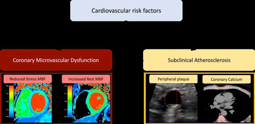 Cardiometabolic Risk Factors Associated With Impaired Coronary ...