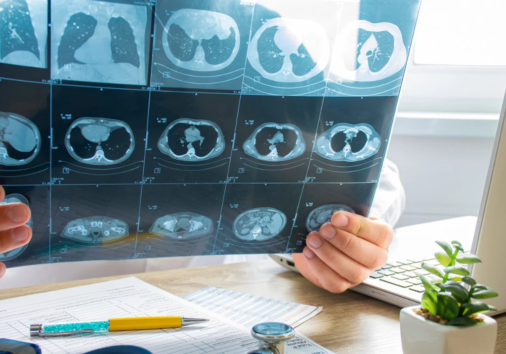 Predicting Mortality and Identifying Incidental Findings in Chest CT ...