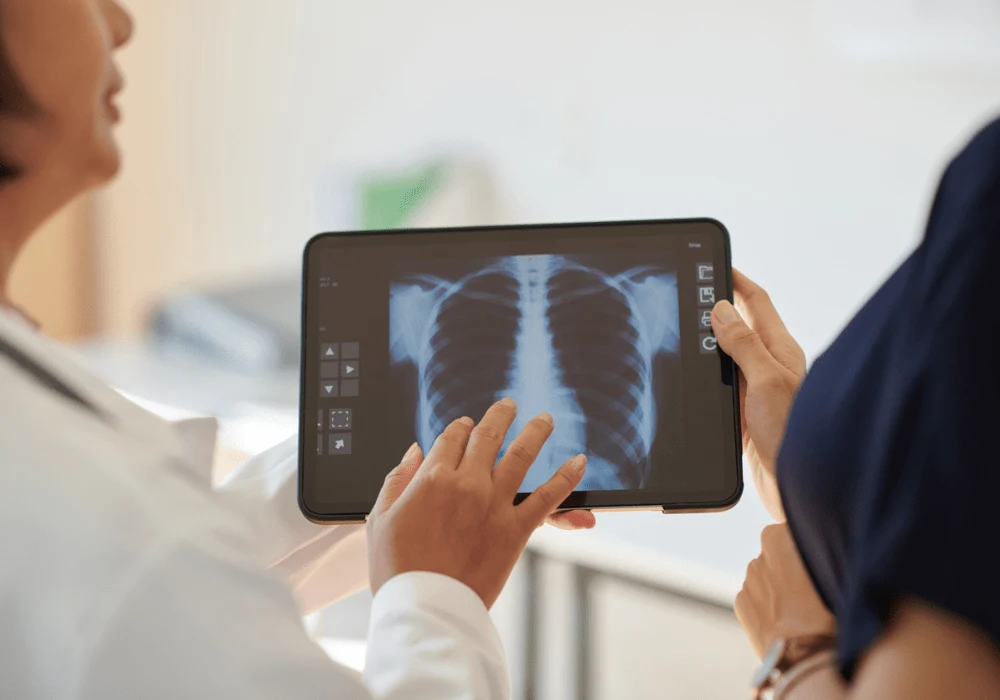 Comparing Commercial and Open-Source LLMs for Radiograph Report Analysis