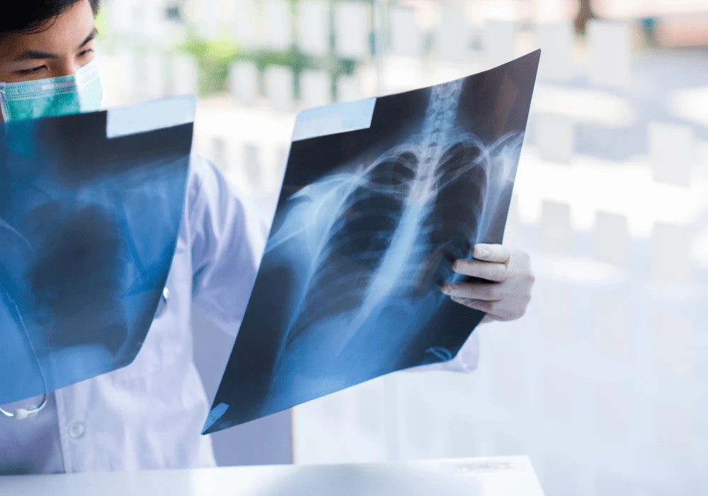 Enhancing Chest Radiograph Quality Control with Automation