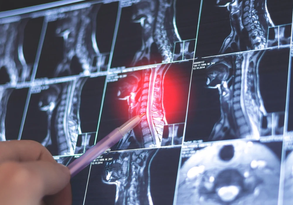 Improving Speed and Quality in Head and Neck MRI with DL