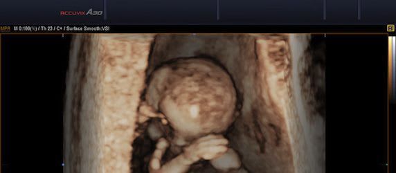 Samsung Launches XGEO GC80 Digital Radiography System ...