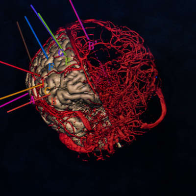 Global Trends for MRI: Fast Forward to 2024 - HealthManagement.org