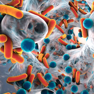 PSP for Early Diagnosis of Post-Operative Peritonitis, Intra-abdominal ...