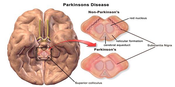 Mapping Technique for Modulation Following Sham Surgery ...