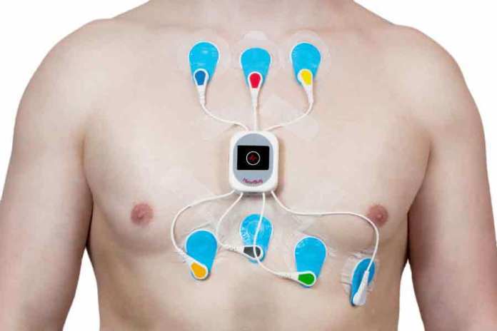 Monitor Your Heart Rhythm at www.superecg.com – Whenever, Wherever ...