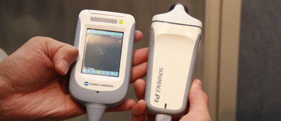 Konica Minolta Acquires Panasonic Healthcare Ultrasound Diagnostic ...