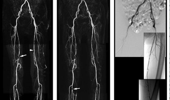 MRI Contrast Agents Compared at Different Dosing - HealthManagement.org