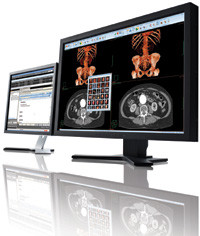Carestream continues to develop new radiology products and advanced IT ...