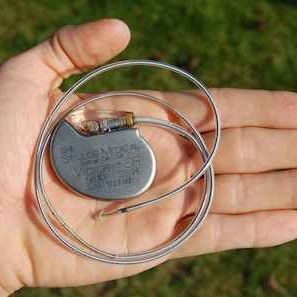 Pacemaker Checks Help Prevent Stroke - HealthManagement.org