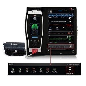 Masimo Introduces Rad-G™ Pulse Oximeter - HealthManagement.org