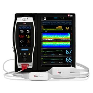 Masimo O3® Regional Oximetry and SedLine® Brain Function Monitoring ...