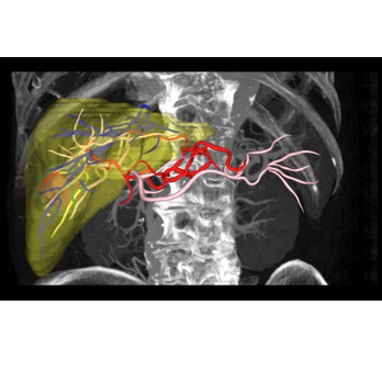 TeraRecon receives first-of-kind FDA determination - HealthManagement.org