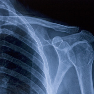 Xrays Reveal State of Soft Tissue - HealthManagement.org