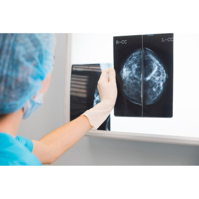 An AI algorithm for Determining Breast Density on BI-RADS Scale ...