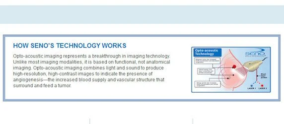 Data: Seno Medical Instruments’ Imagio® Might Eliminate Breast Biopsy Need