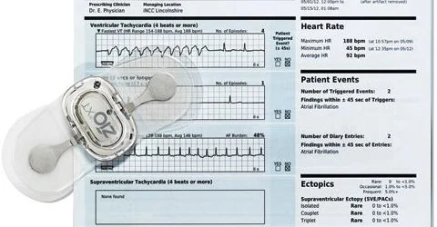 Study: Traditional Holter Monitor Outperformed by ZIO Service ...