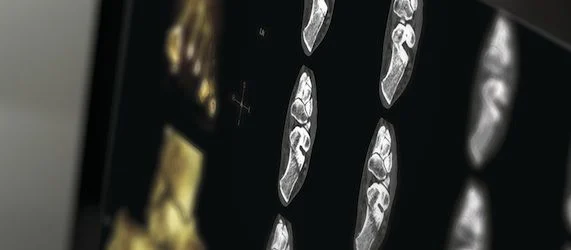 RSNA 2013: Barco to Present Portfolio of Imaging Solutions Focused on ...