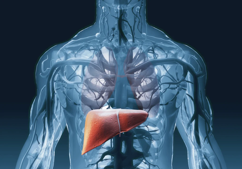 Deep Learning & Iterative CT Reconstruction for Liver Metastasis Detection
