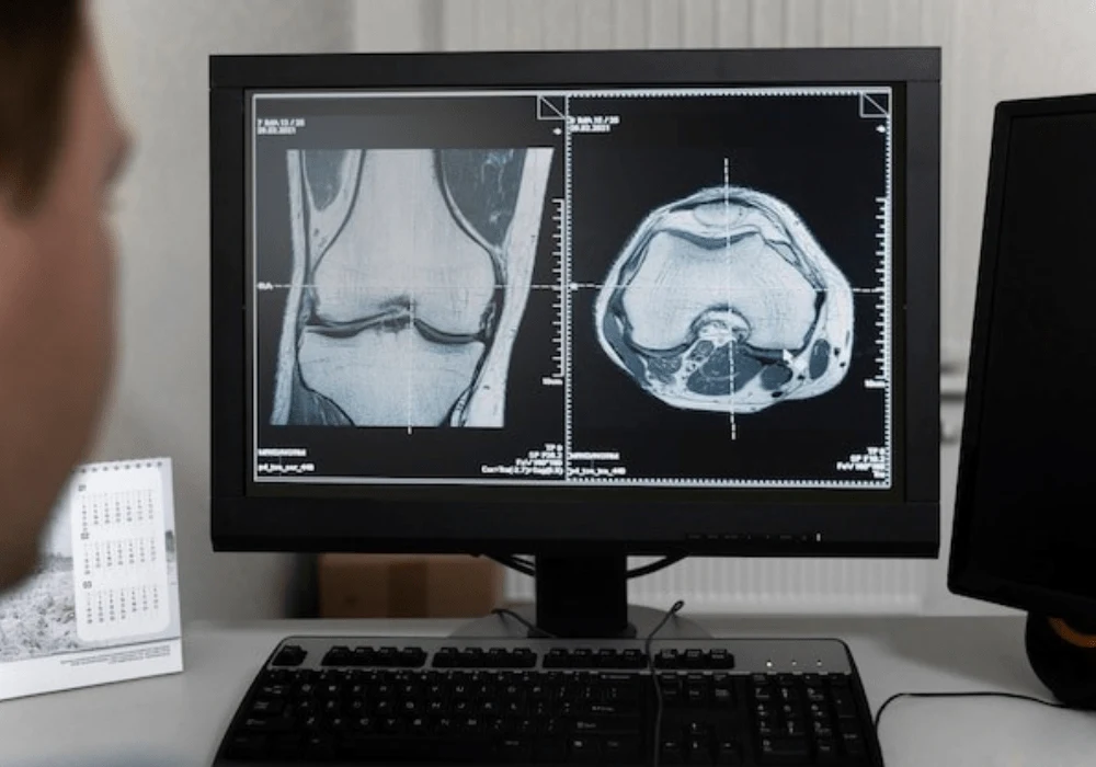 MRI as an Alternative to CT for Bone Tumour Surgery Planning