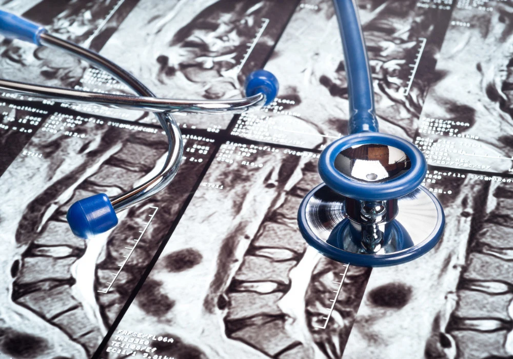 Optimising MR Neurography of the Lumbosacral Plexus