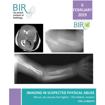 Imaging in suspected physical abuse