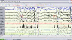 Health Management and Leadership Portal | Mobile electroencephalograph ...