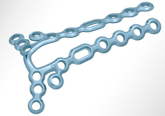 Health Management and Leadership Portal | Radius compression bone plate ...