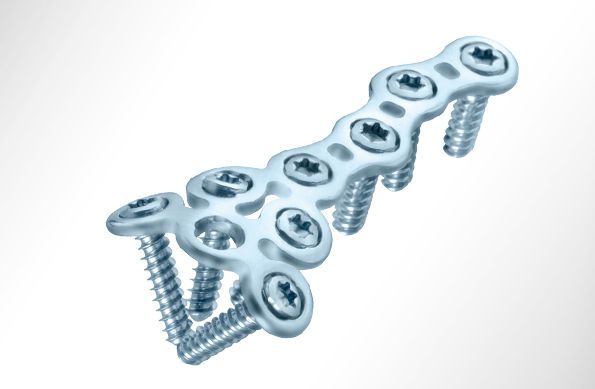 Health Management and Leadership Portal | Radius compression bone plate ...