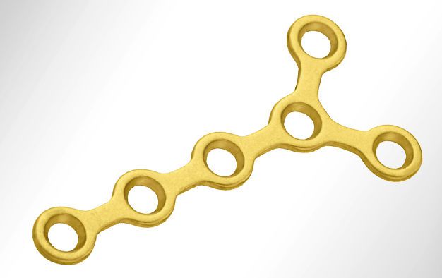 Health Management and Leadership Portal | Ulna compression bone plate ...