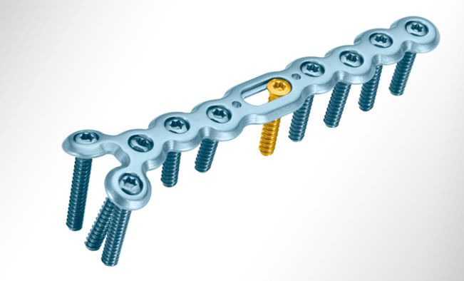 Health Management and Leadership Portal | Radial head compression bone ...