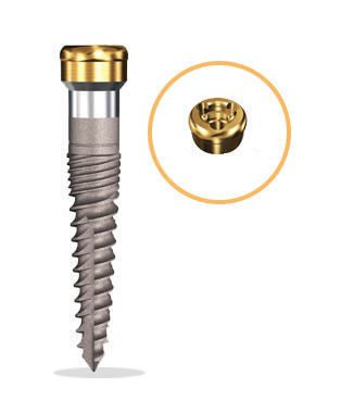 Health Management and Leadership Portal | Conical dental implant ...